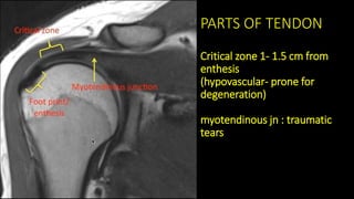 HOW TO READ SHOULDER MRI | PPT