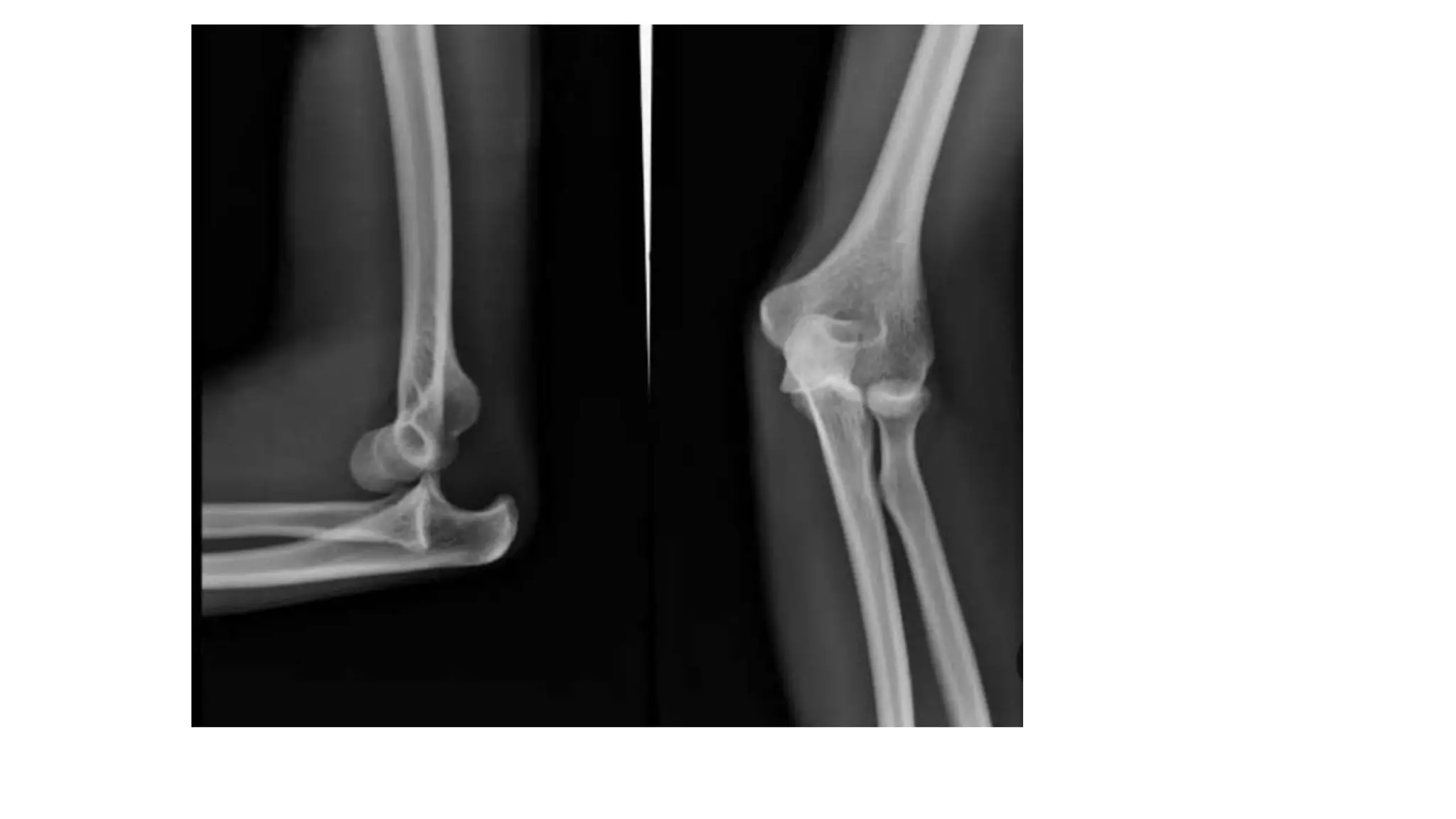 How to read X-ray film.pptx