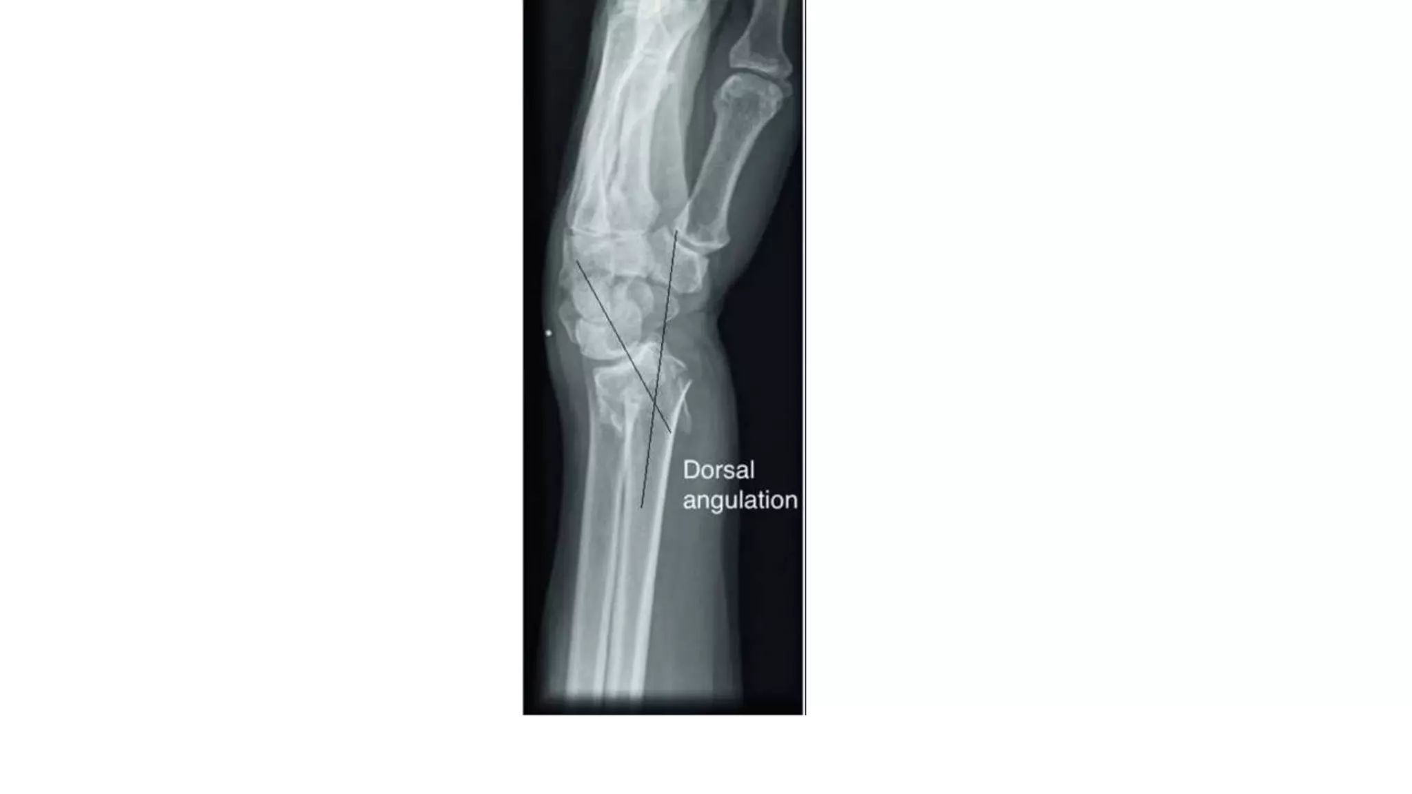 How to read X-ray film.pptx