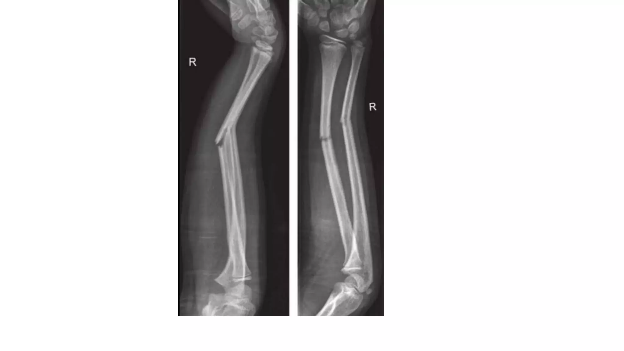How to read X-ray film.pptx