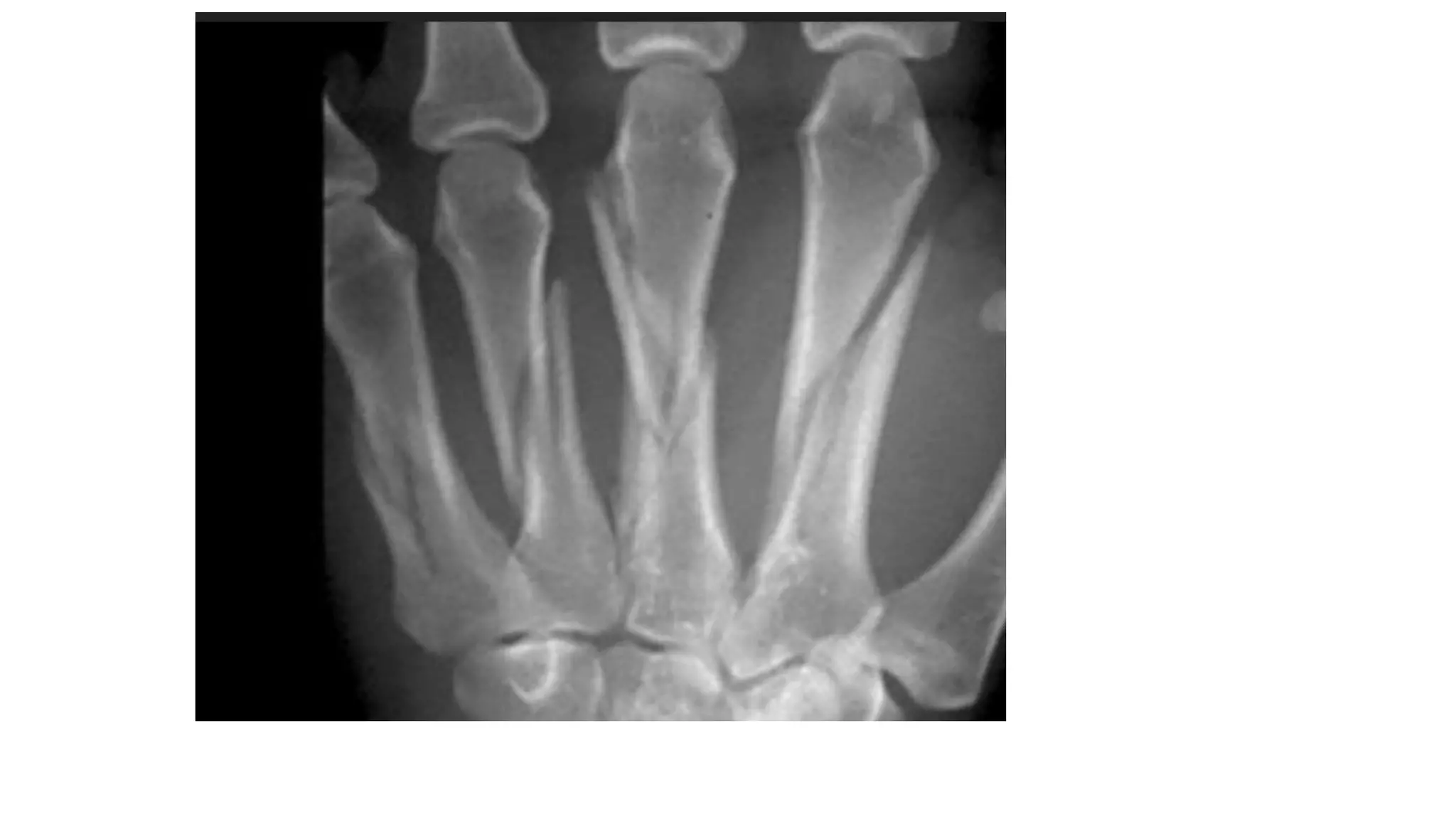 How to read X-ray film.pptx