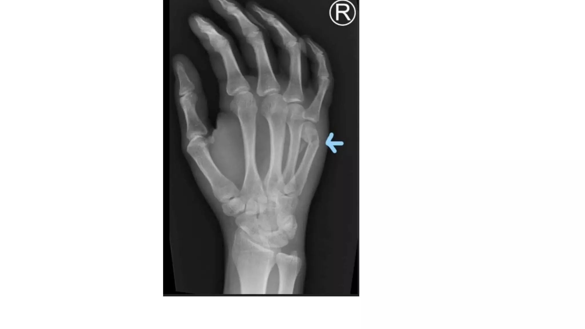 How to read X-ray film.pptx
