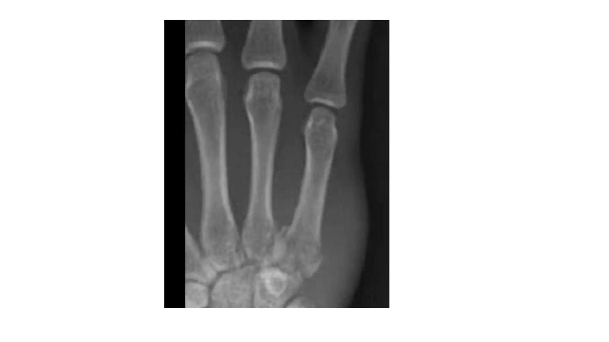 How to read X-ray film.pptx