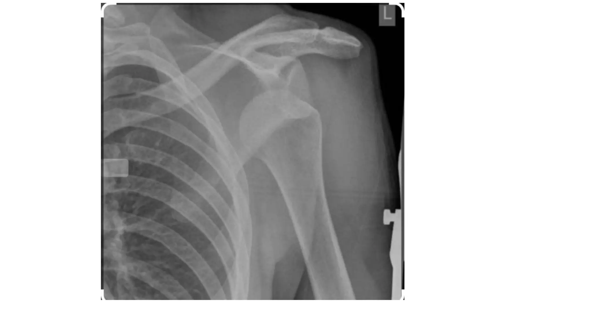 How to read X-ray film.pptx