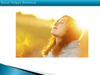How To Remove Nasal Polyps Naturally Without Surgery | PPTX