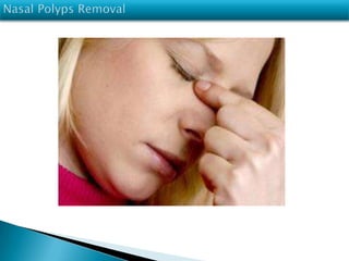 How To Remove Nasal Polyps Naturally Without Surgery | PPTX