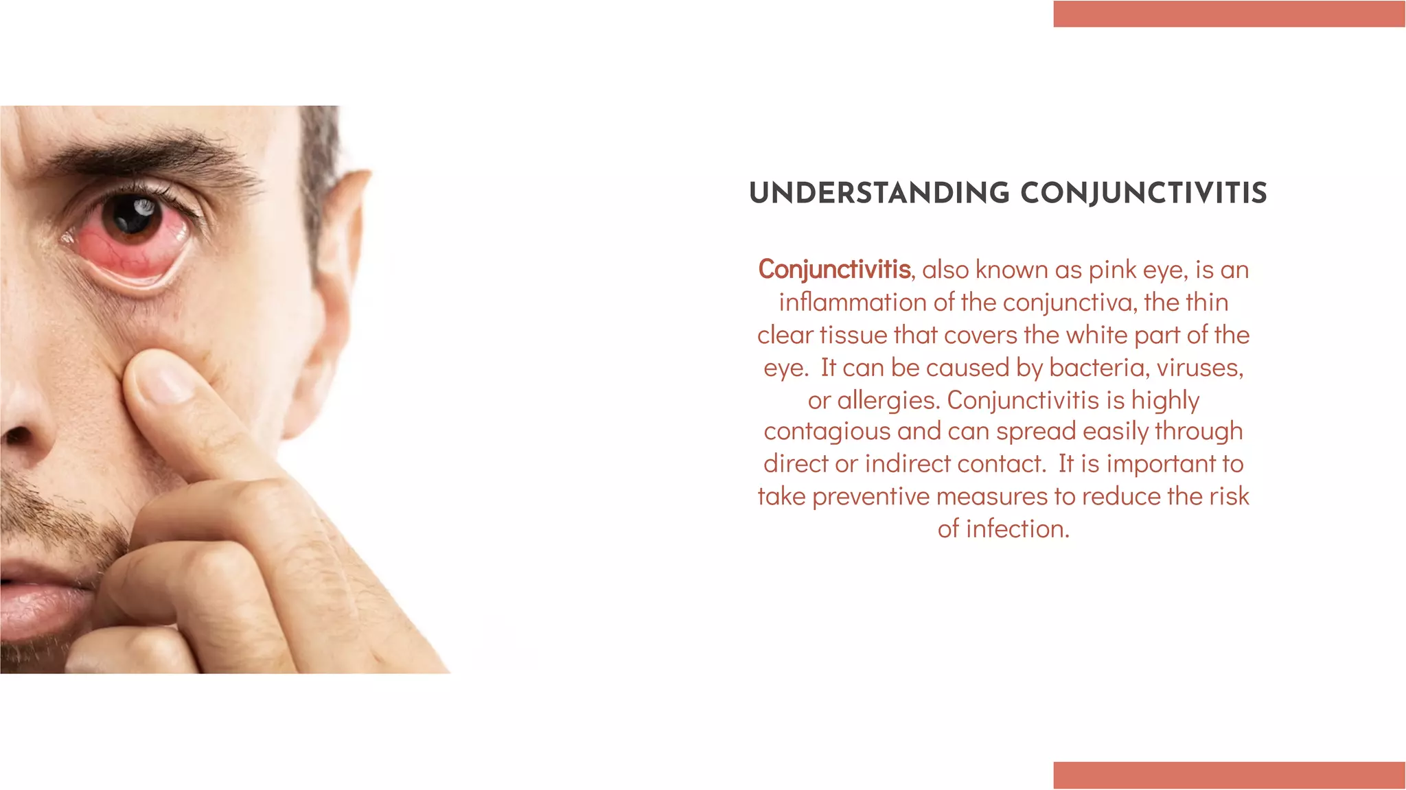 How to Safe your child from conjunctivitis | Amit Kakkar Healthway | PDF