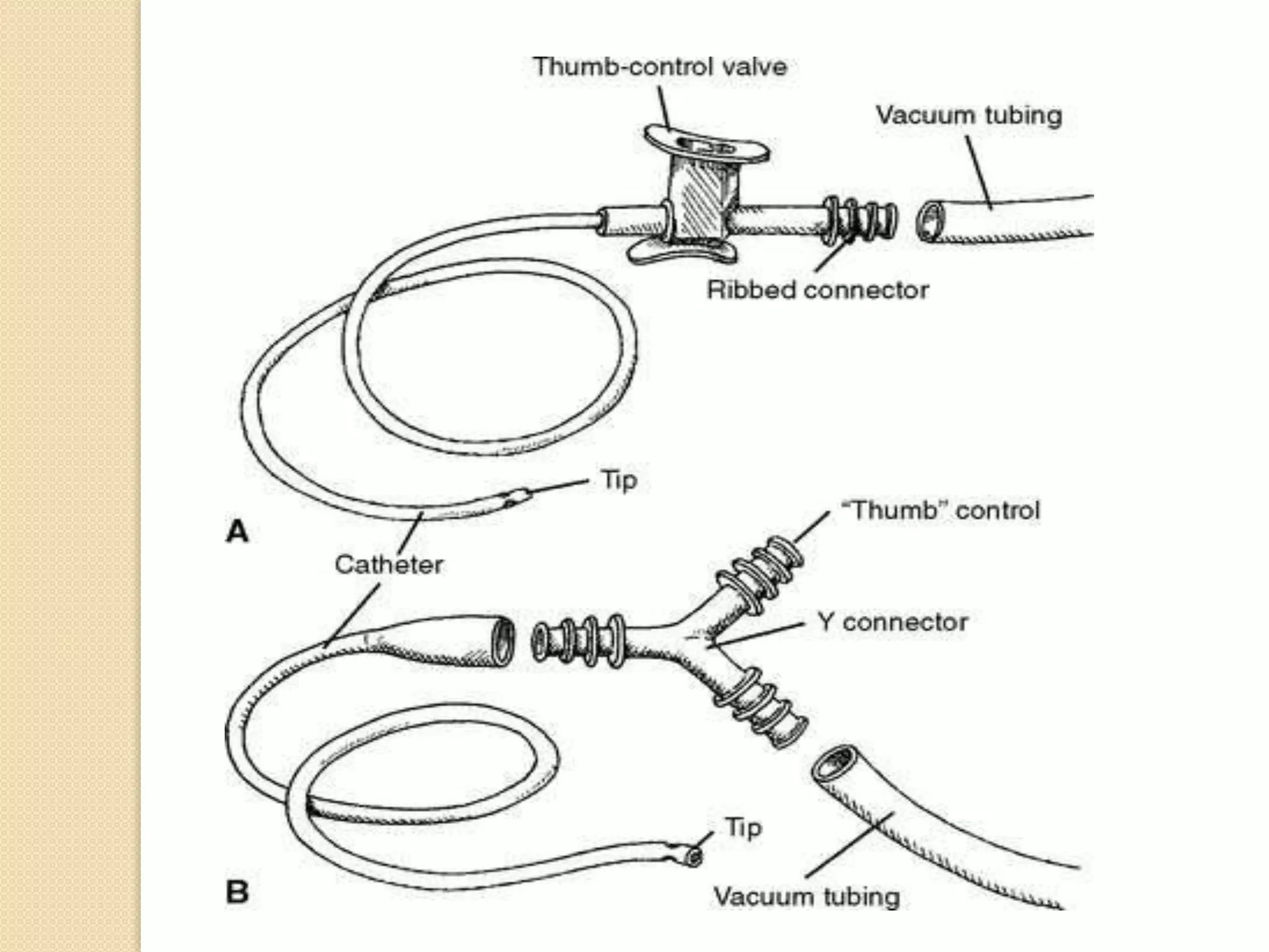 HOW TO SET UP INTUBATION TRAY IN OT-PRACTICAL.pptx