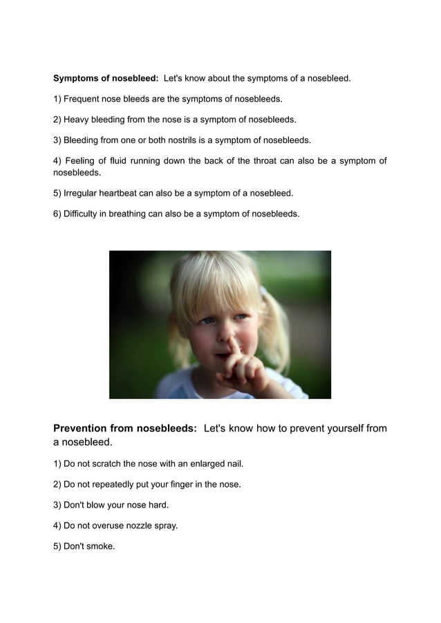 How to stop a nose bleed at home.pdf