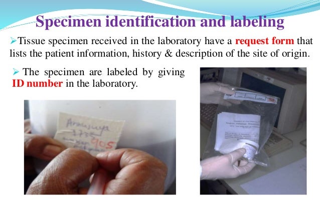 How to submit biopsy specimens for histopathology