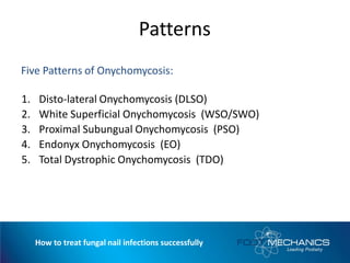 How to successfully treat fungal nail infections - GP Workshop Summary ...
