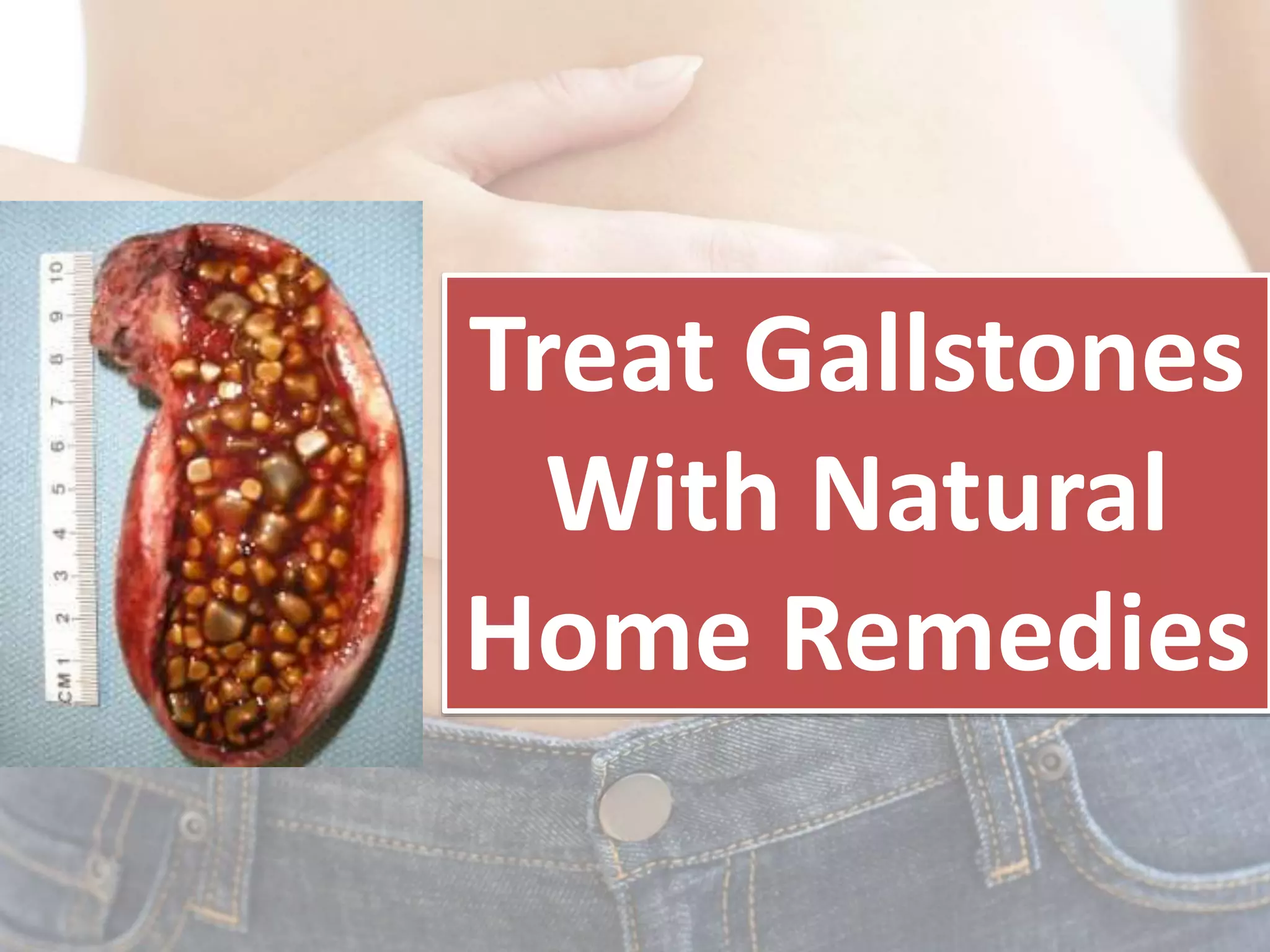 How to treat gallbladder stones with natural remedies | PPTX