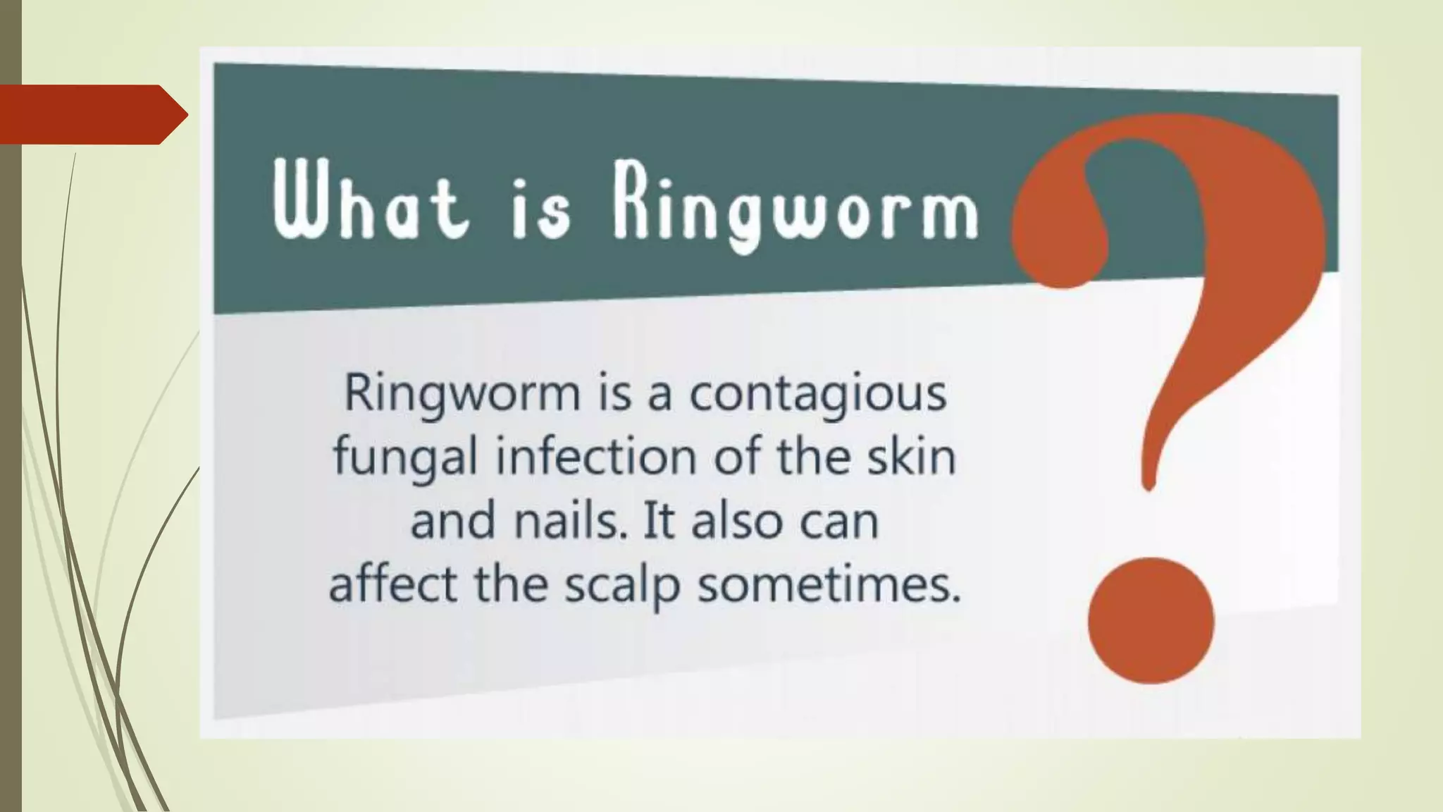 How to treat ringworm in babies - Curecity | PPT