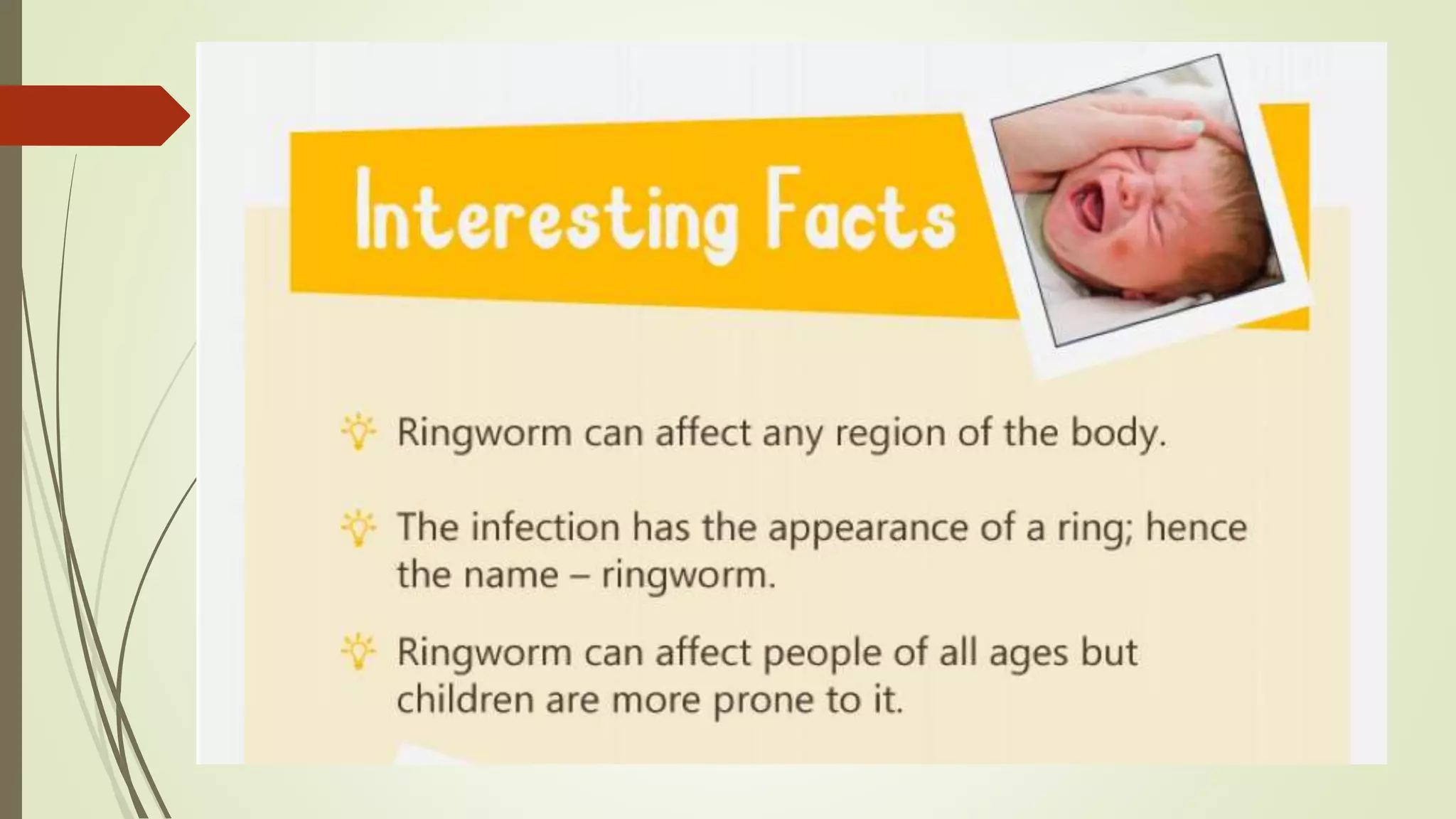 How to treat ringworm in babies - Curecity | PPTX