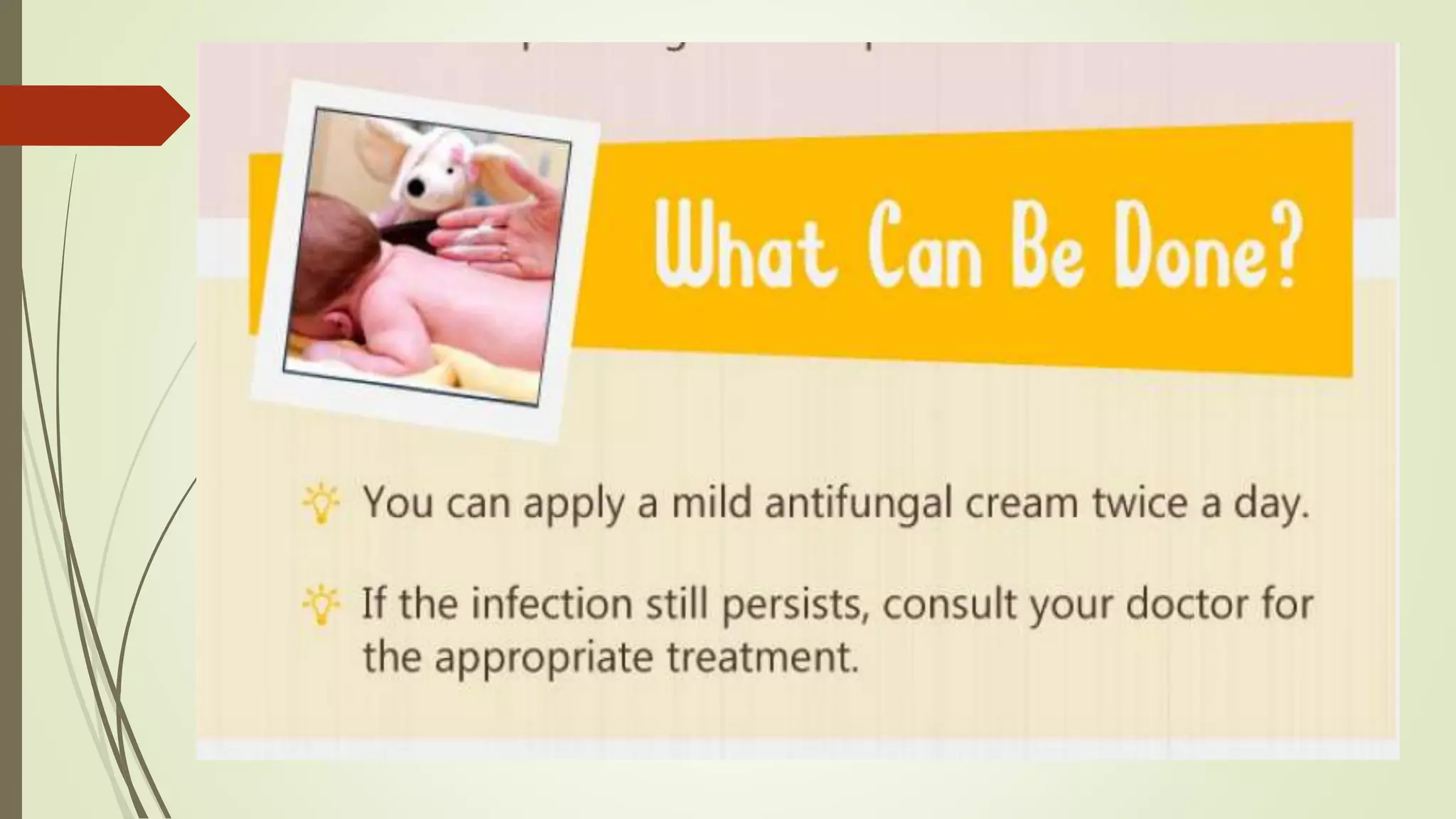 How to treat ringworm in babies - Curecity | PPTX