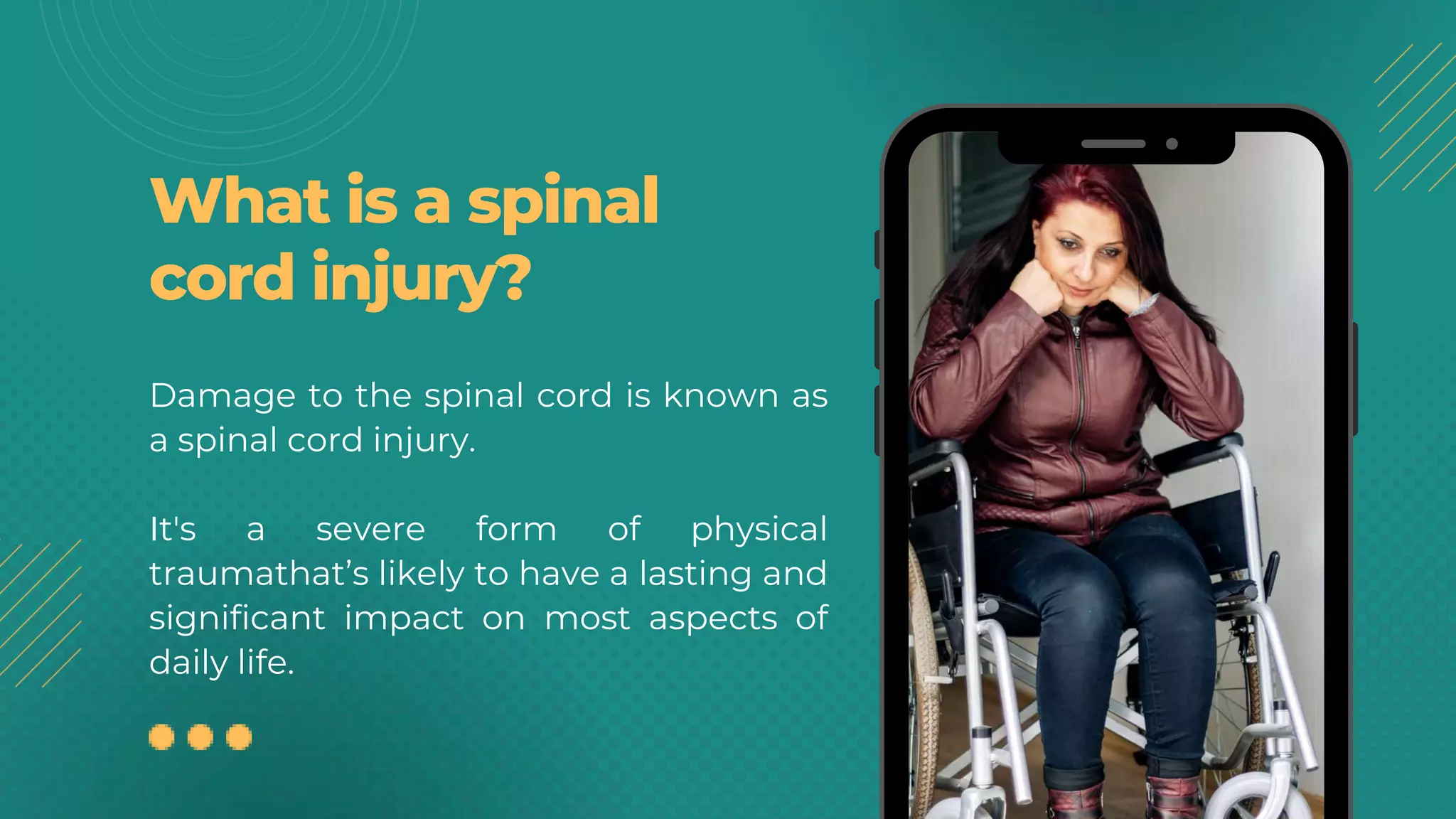 How to Treat Spinal Cord Injuries With Stem Cell Therapy - Dr. David ...