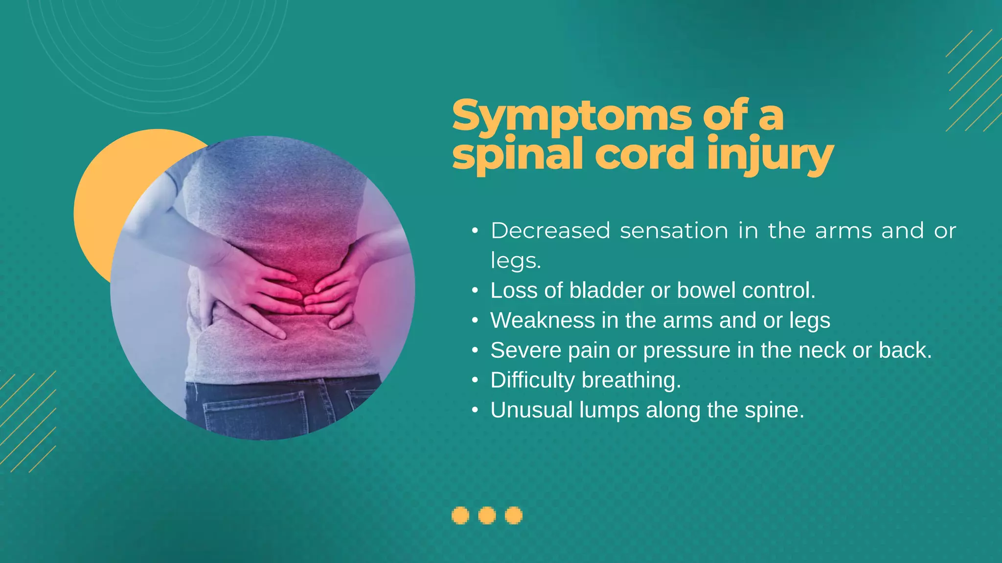 How to Treat Spinal Cord Injuries With Stem Cell Therapy - Dr. David ...
