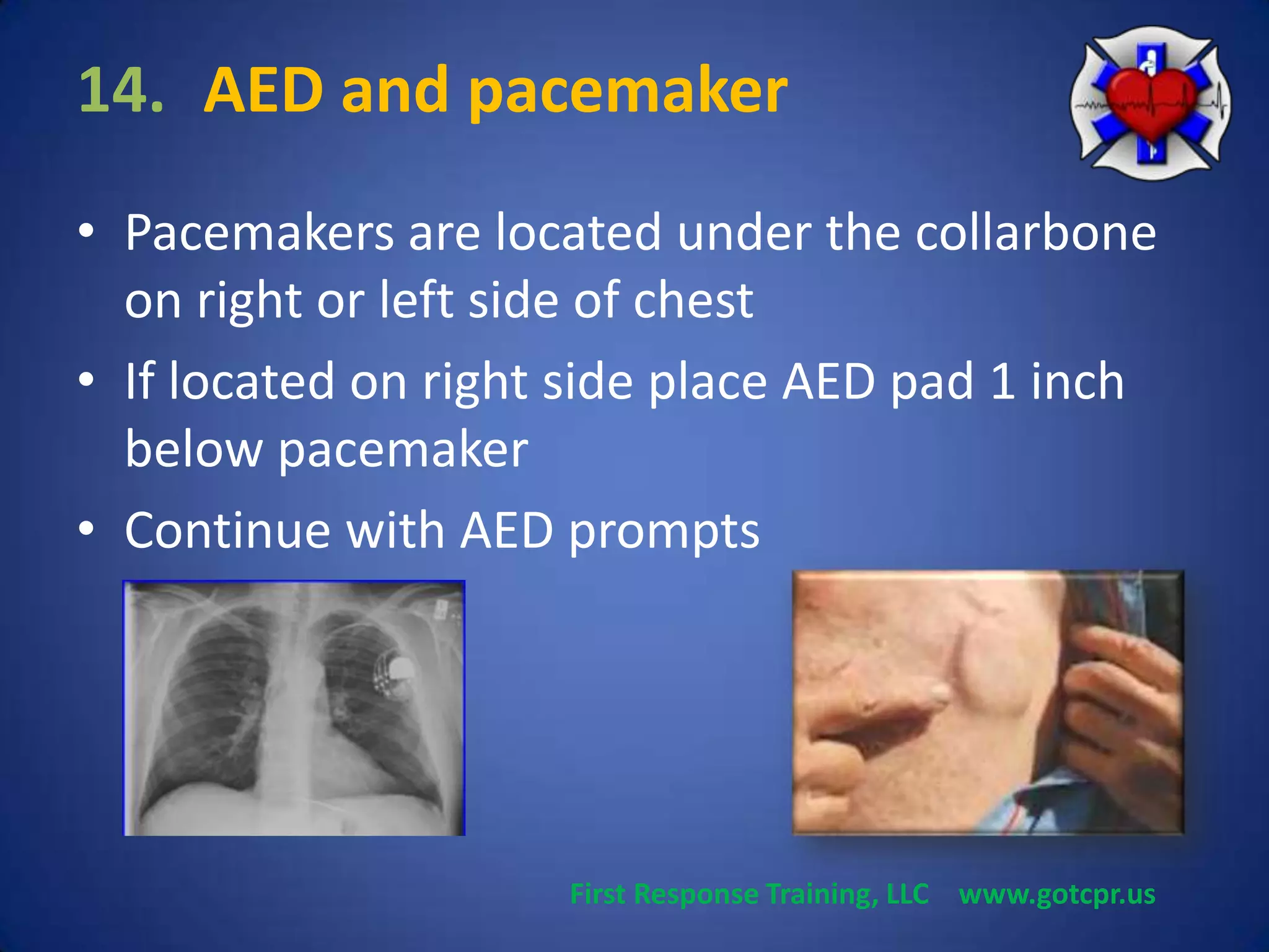 How to use an Automated External Defibrillator (AED) | PPTX