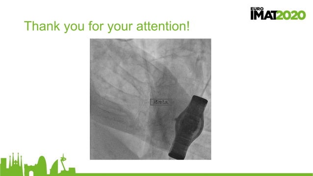 How to Use Cangrelor - Dr. Geisler | PDF