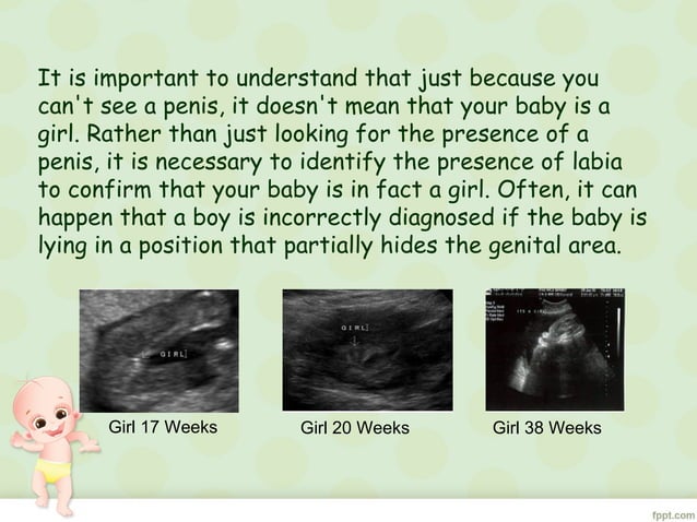 How will an ultrasound help us to know the gender of the pre birth baby ...