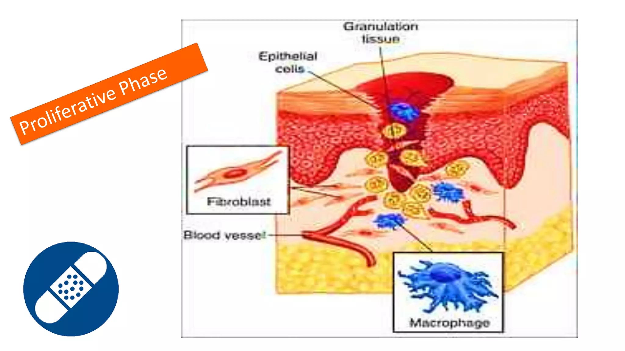 How wound heal process- a brief medical study | PPT