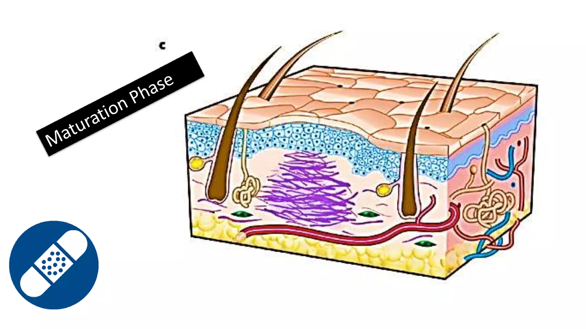 How wound heal process- a brief medical study | PPT