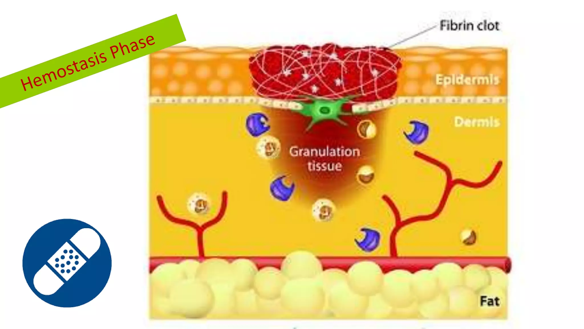 How wound heal process- a brief medical study | PPT
