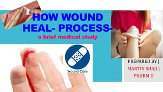 How wound heal process- a brief medical study | PPT