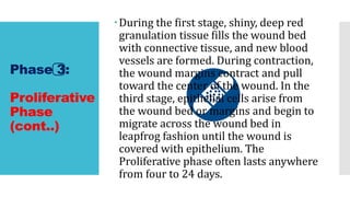 How wound heal process- a brief medical study | PPT