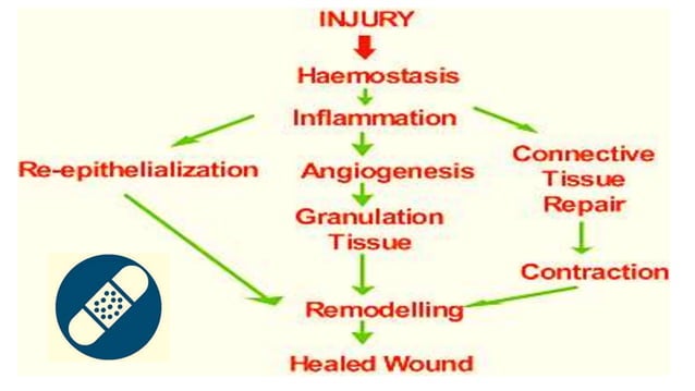 How wound heal process- a brief medical study | PPT