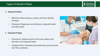 How X-Rays Help in Early Detection and Treatment.pptx