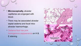HP-13 &14 disturbance of circulation .pptx