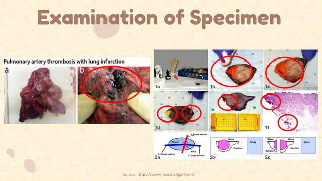 Histological Techniques: Perform Fixation and Tissue Processing | PDF