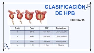 Hpb Pptx Hiperplasia Prostatica Benignan Pptx