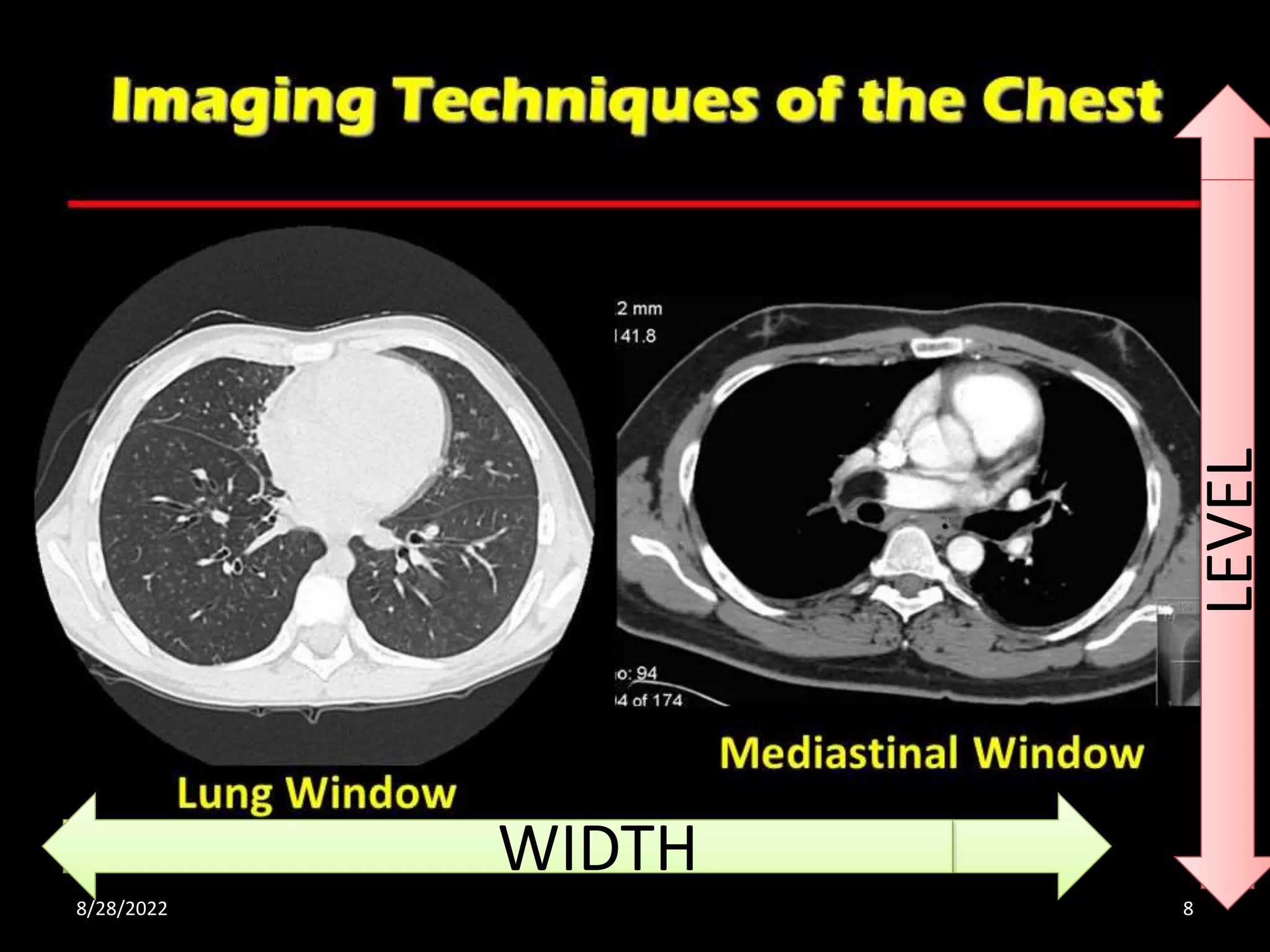 IMAGING IN HEPATOPANCREATICOBILIARY TUMORS - A GUIDE TO RT PLANNING | PPT