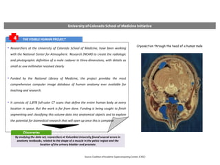 HPC in healthcare | PPT