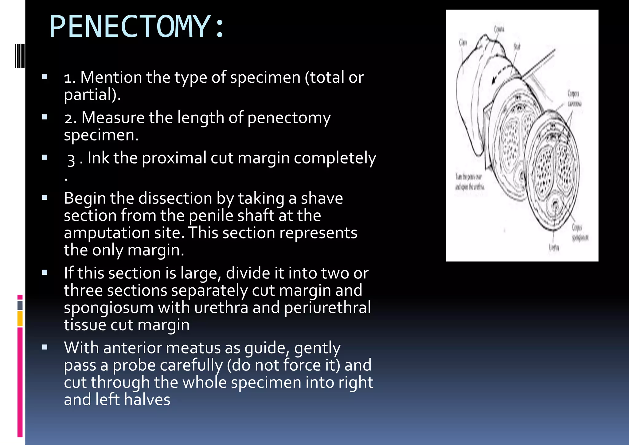 HPE GROSSING OF PENECTOMY | PPTX