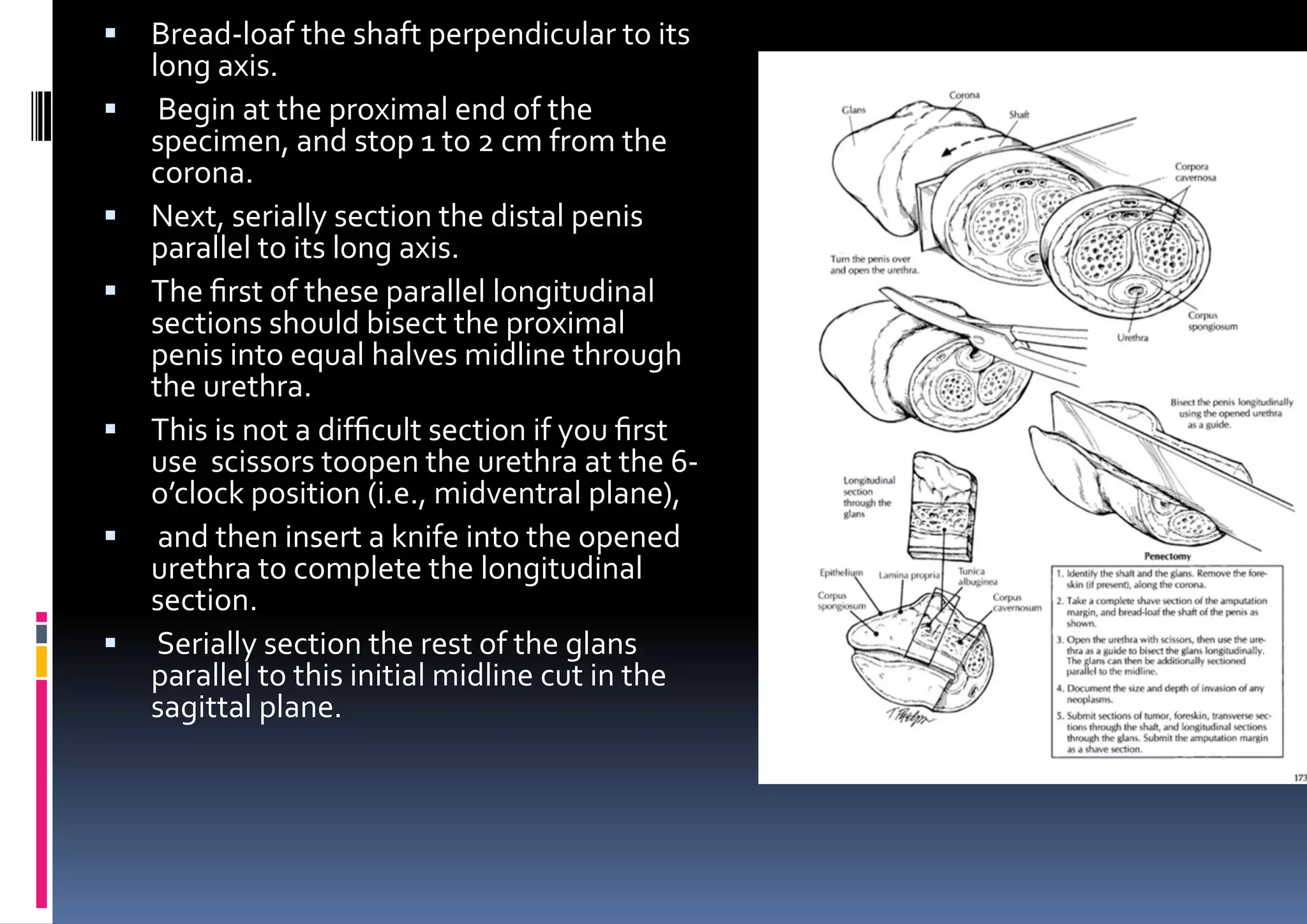 HPE GROSSING OF PENECTOMY | PPTX
