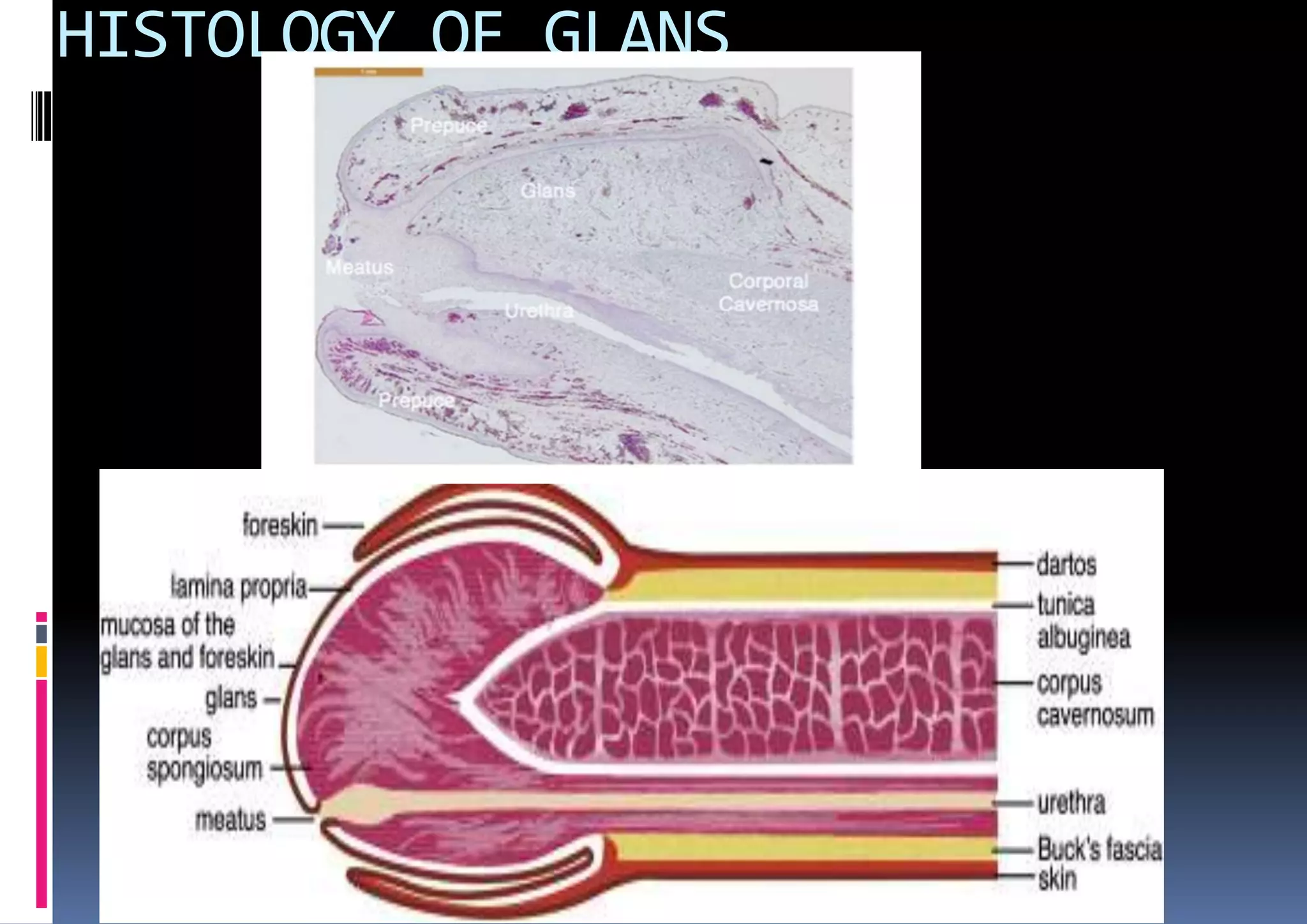 HPE GROSSING OF PENECTOMY | PPTX