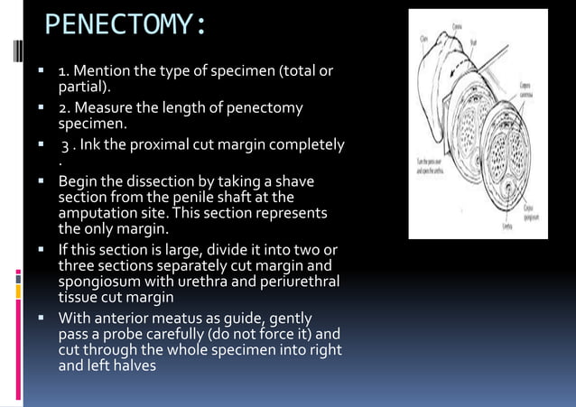 HPE GROSSING OF PENECTOMY | PPTX