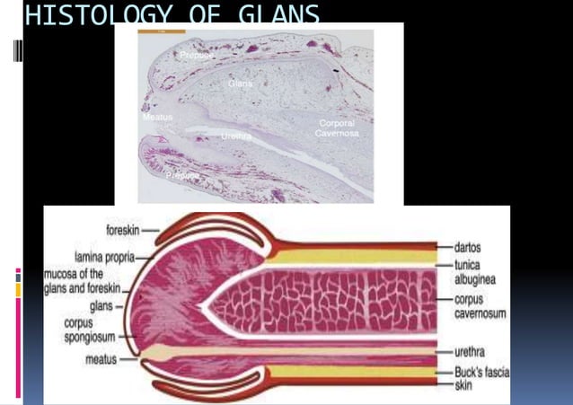 HPE GROSSING OF PENECTOMY | PPTX