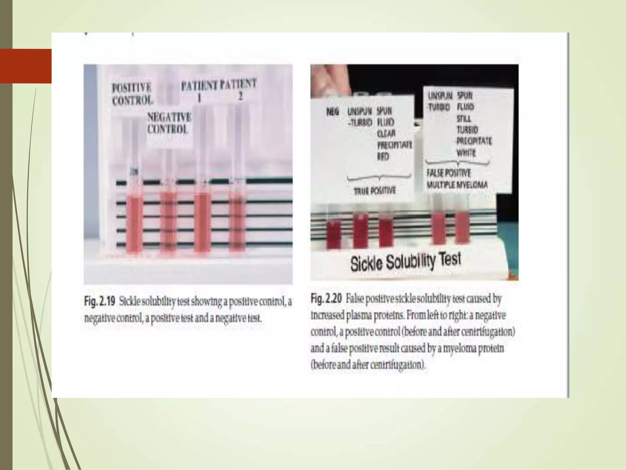 Hplc interpretation | PPT