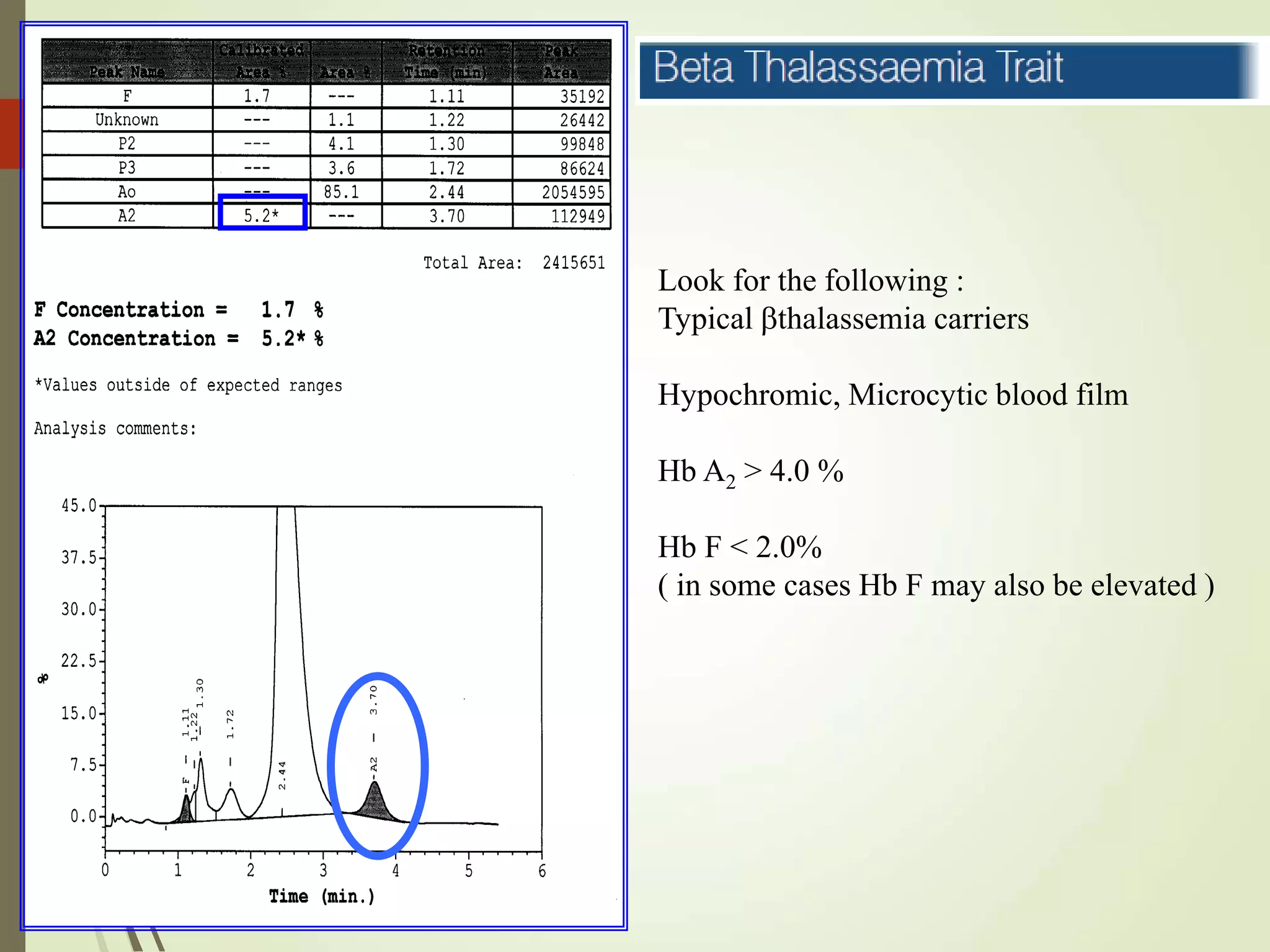 Hplc interpretation | PPT