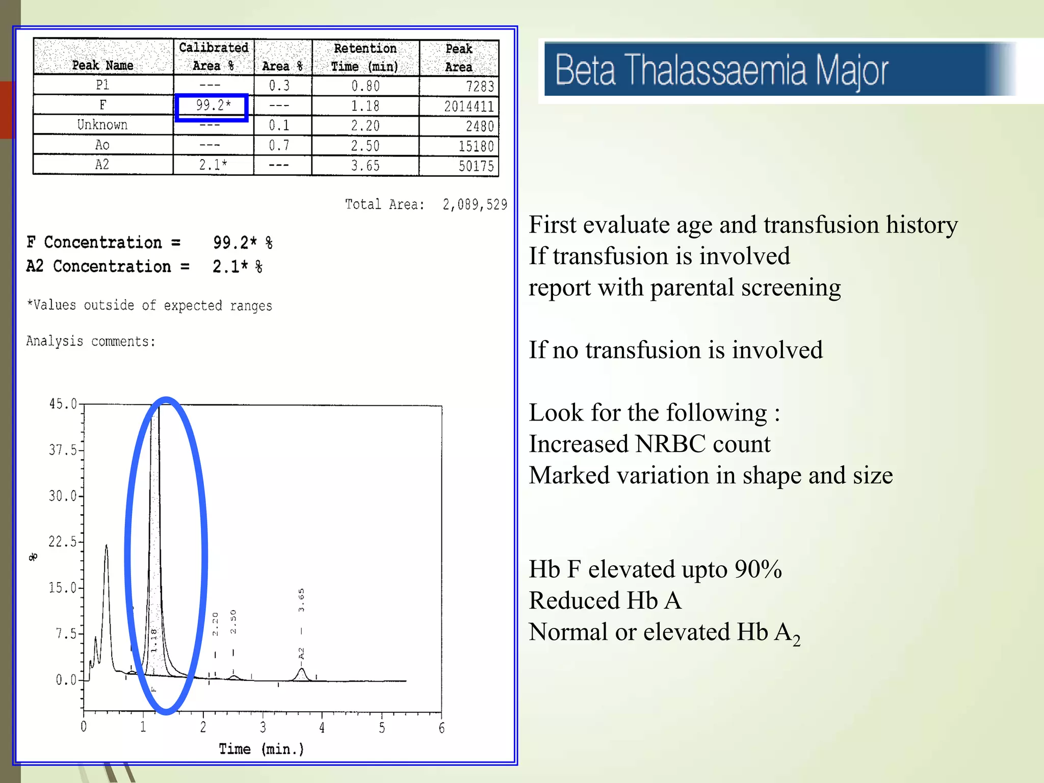 Hplc interpretation | PPT