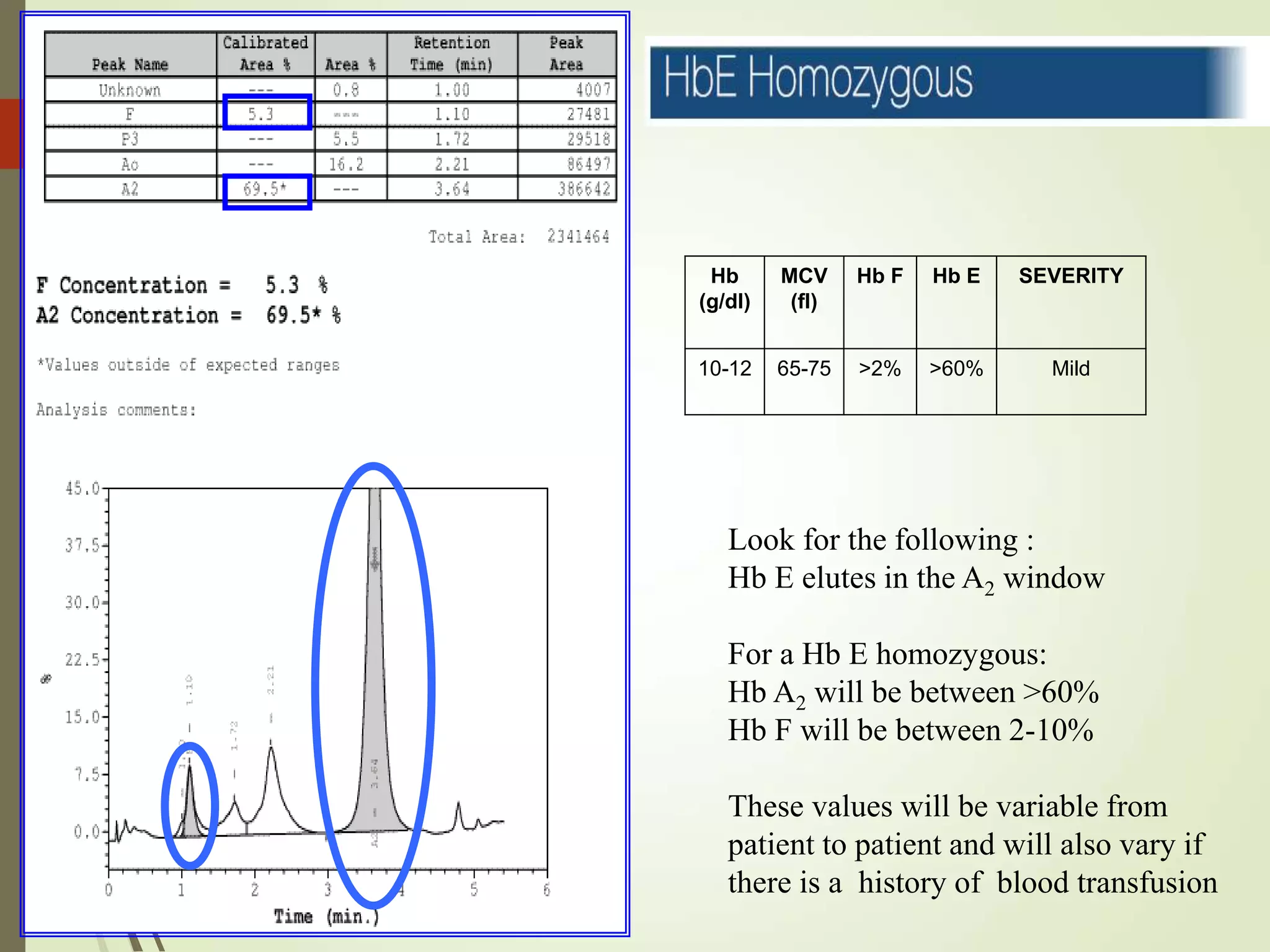 Hplc interpretation | PPT