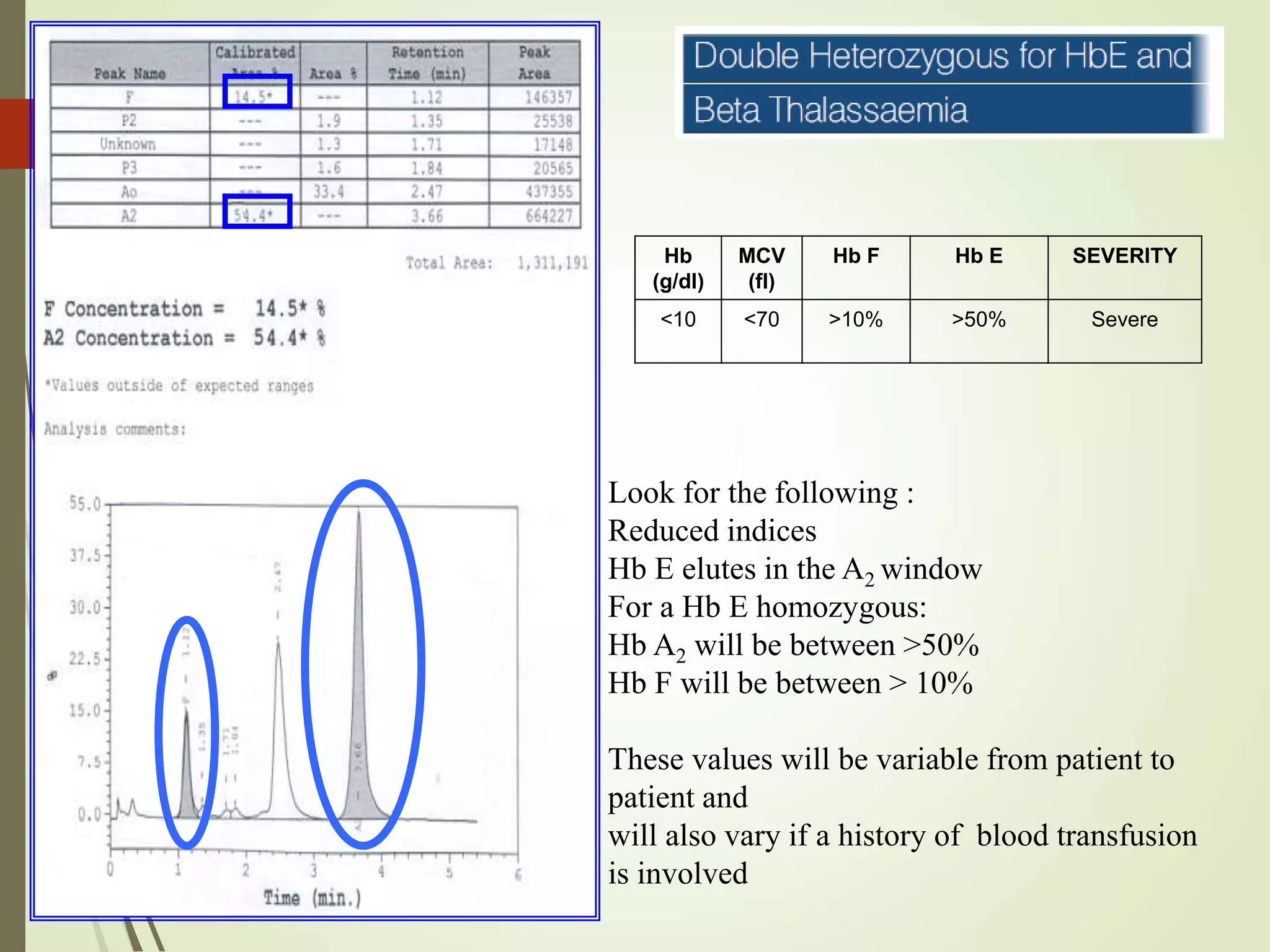 Hplc interpretation | PPT