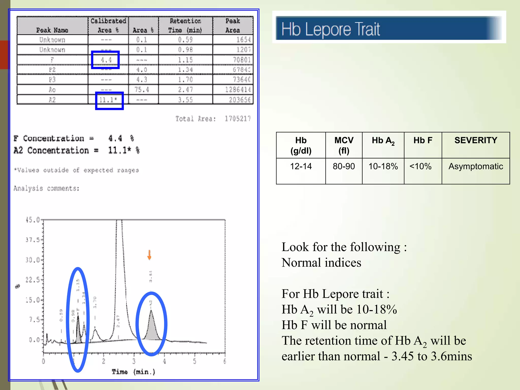 Hplc interpretation | PPT