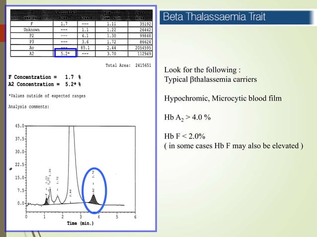 Hplc interpretation | PPT