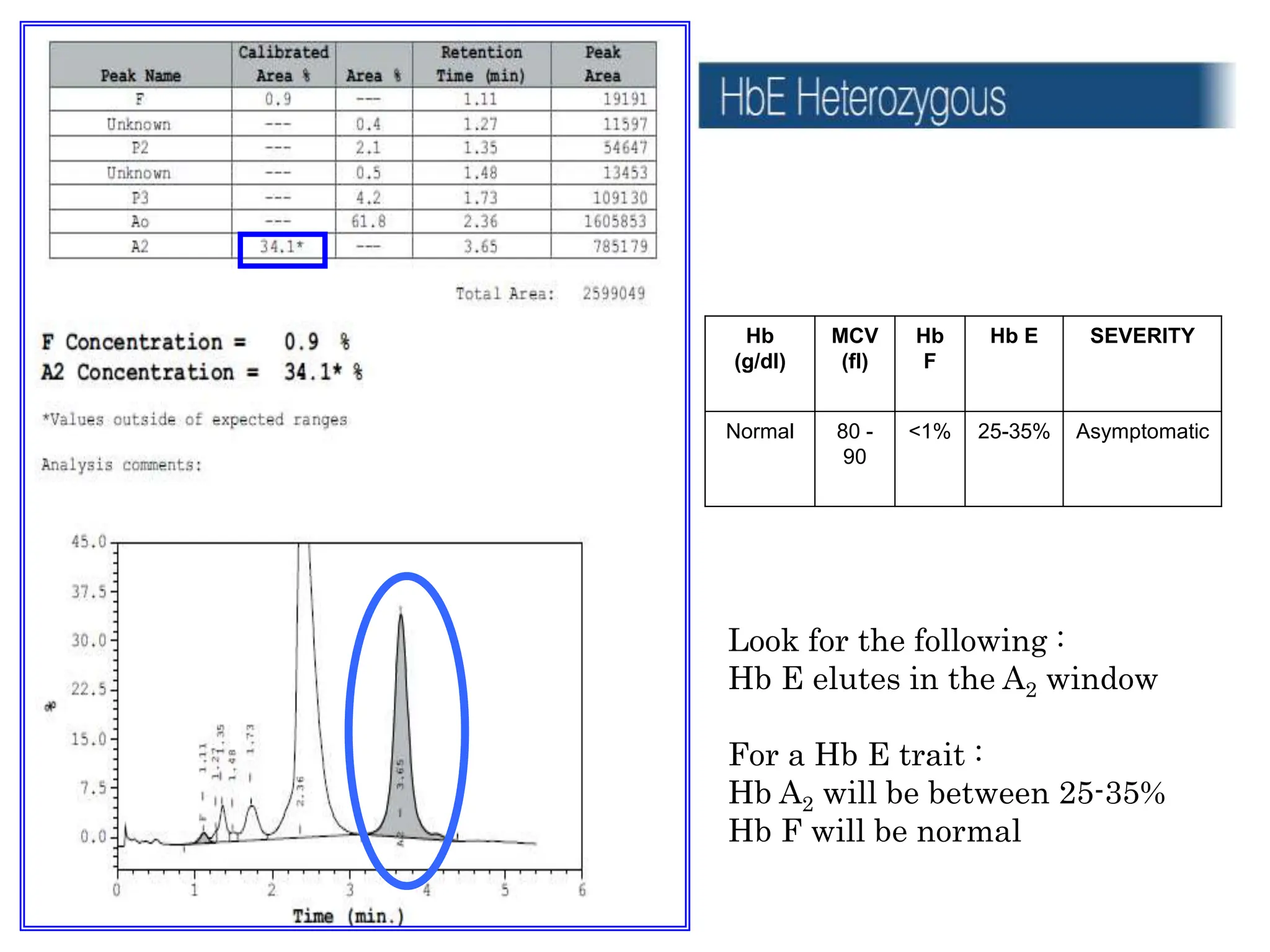 High Performance Liquid chromatography INTERPRETATION.ppt