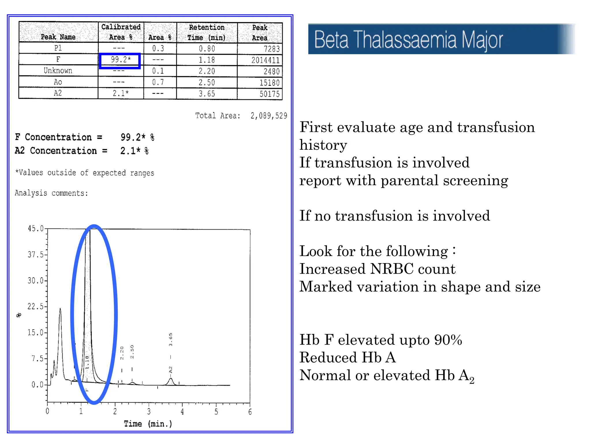 High Performance Liquid chromatography INTERPRETATION.ppt